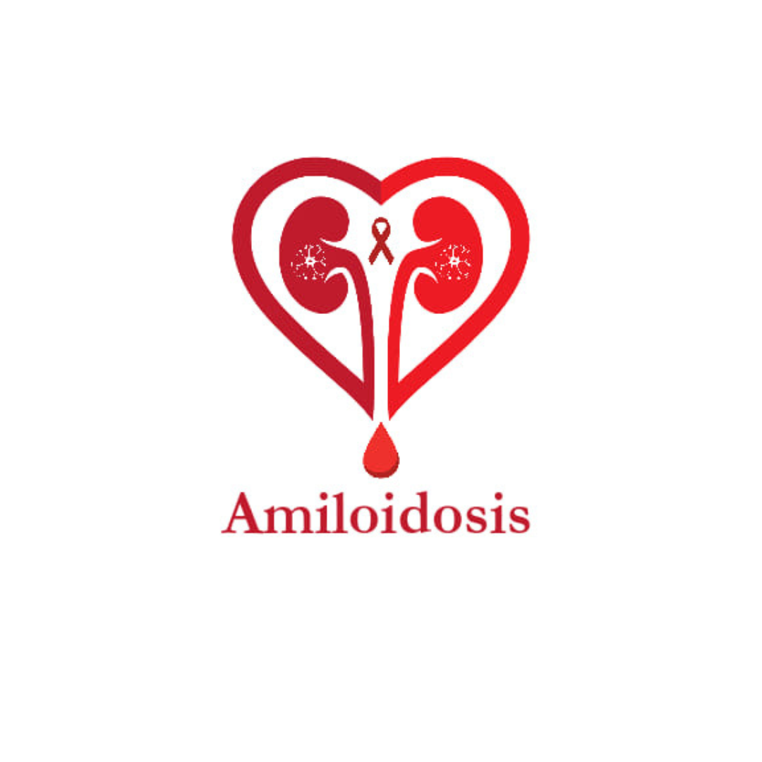 Amiloidosis Costa Rica - Federación Costarricense de Enfermedades Raras